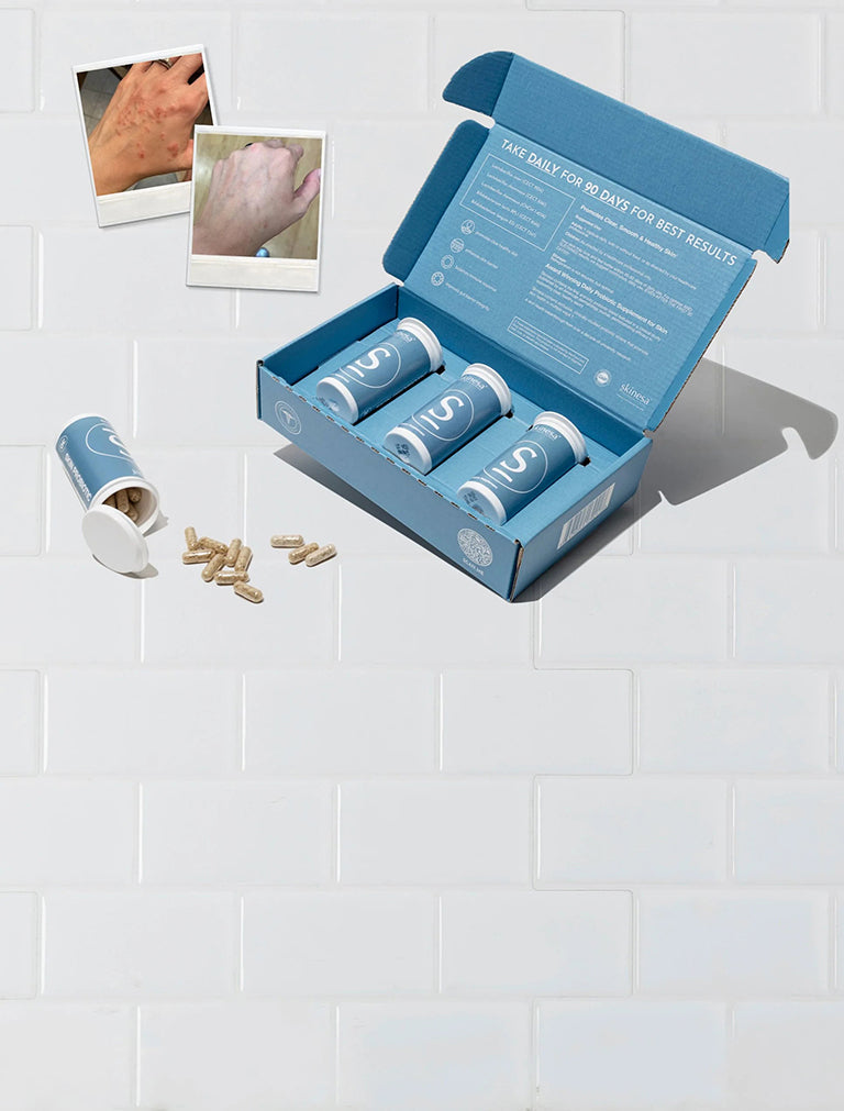 Skinesa® | Skin Probiotics | Best Probiotics for Skin Health